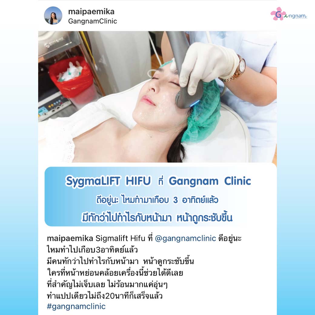 Sygmalift Hifu ยกกระชับ ปรับรูปหน้า เห็นผลทันทีหลังทำ พิเศษเฉพาะกังนัม ...