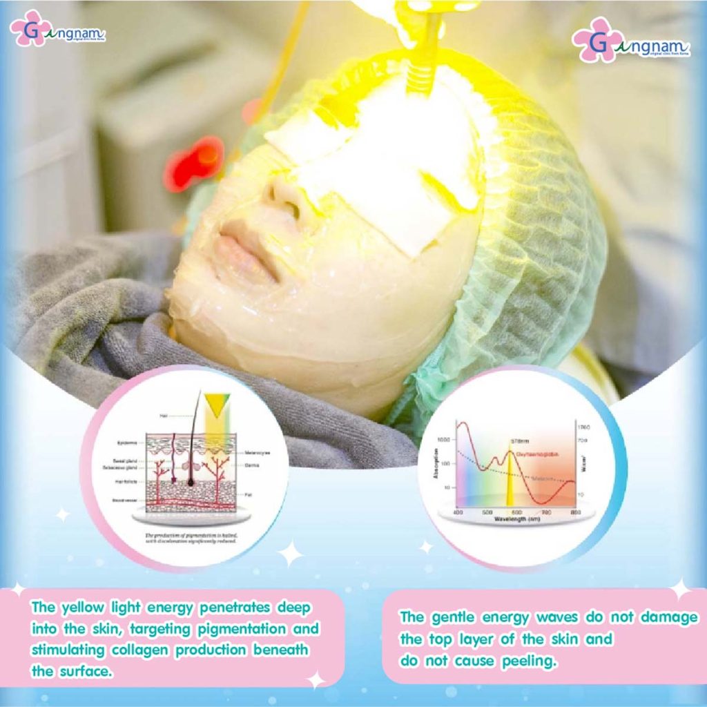 เลเซอร์หน้าใส ลดรอยดำรอยแดงจากสิว รักษาจุดด่างดำ ครั้งแรกเห็นผล